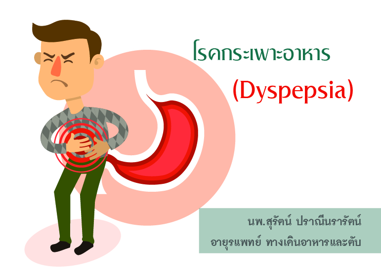 โรคกระเพาะอาหาร (Dyspepsia) – โรงพยาบาลบางโพ